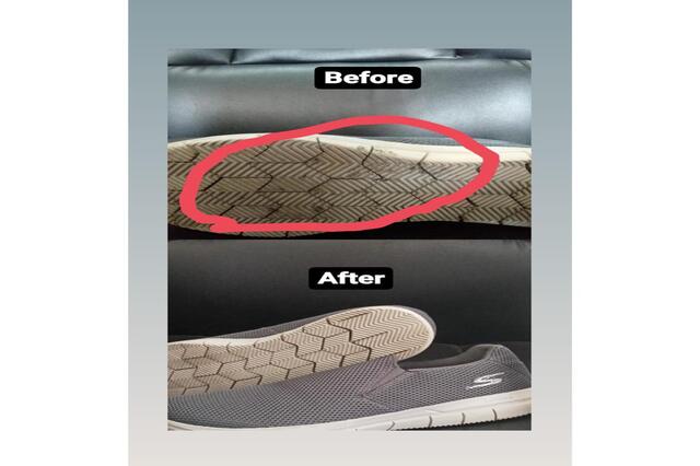 Shoezal Shoes Treatment